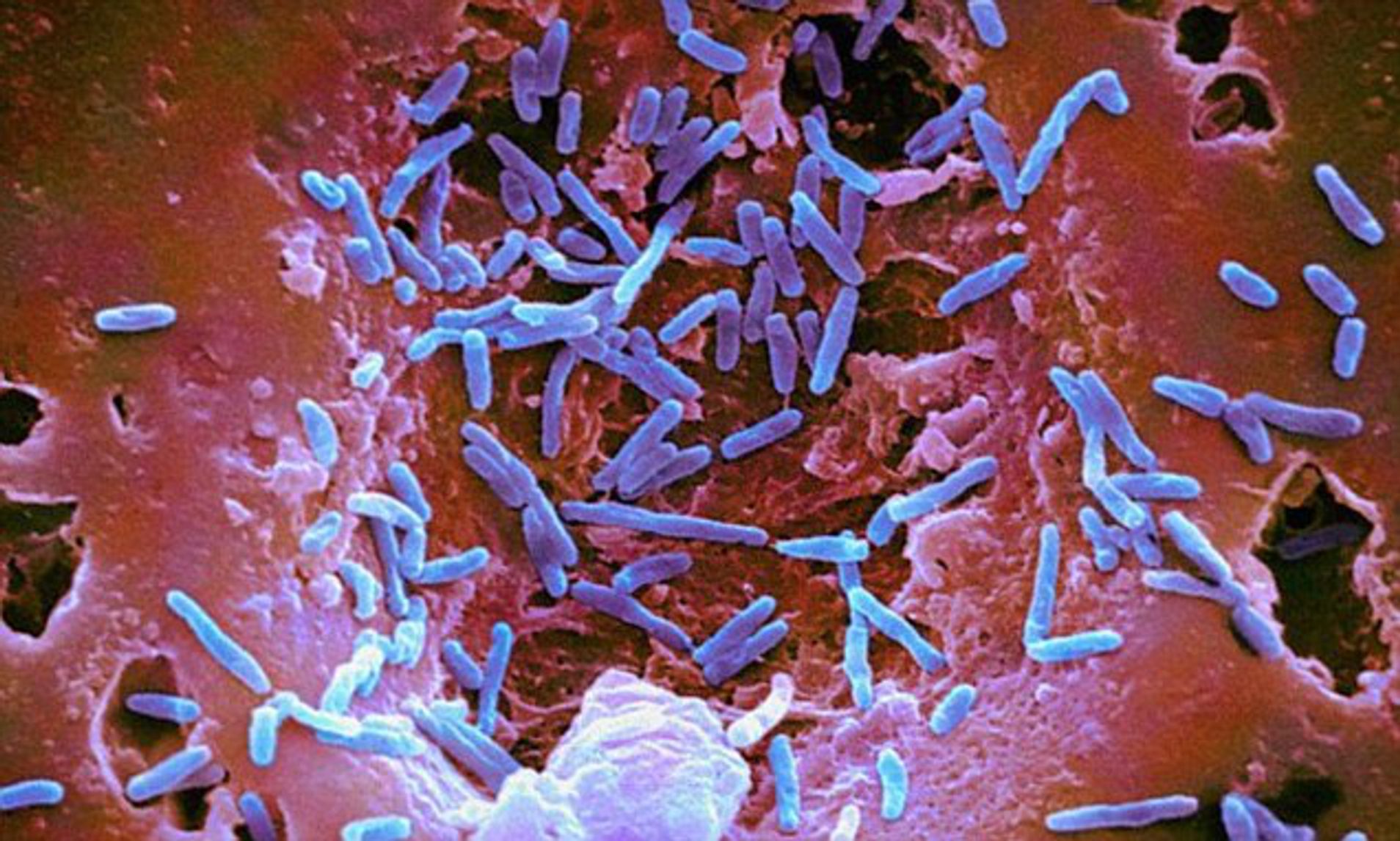 Bactérias: O que são, Tipos, Nutrição, Reprodução e Doenças - Cannalize
